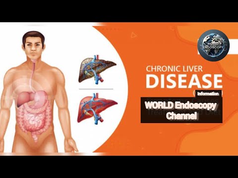 Chronic Liver Disease (CLD) Kya Hai? | CLD 2025 Full Information in Hindi