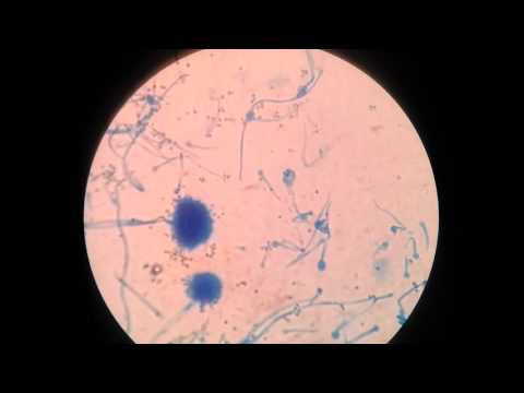 Vegetative forms of fungi i.e. yeast cell, budding, pseudohypha, aseptate and septate hyphae...