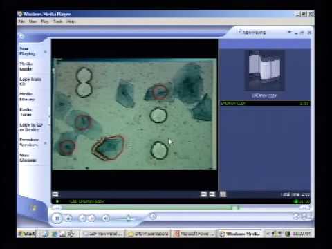LMD4SUPV : 3 : Dissections