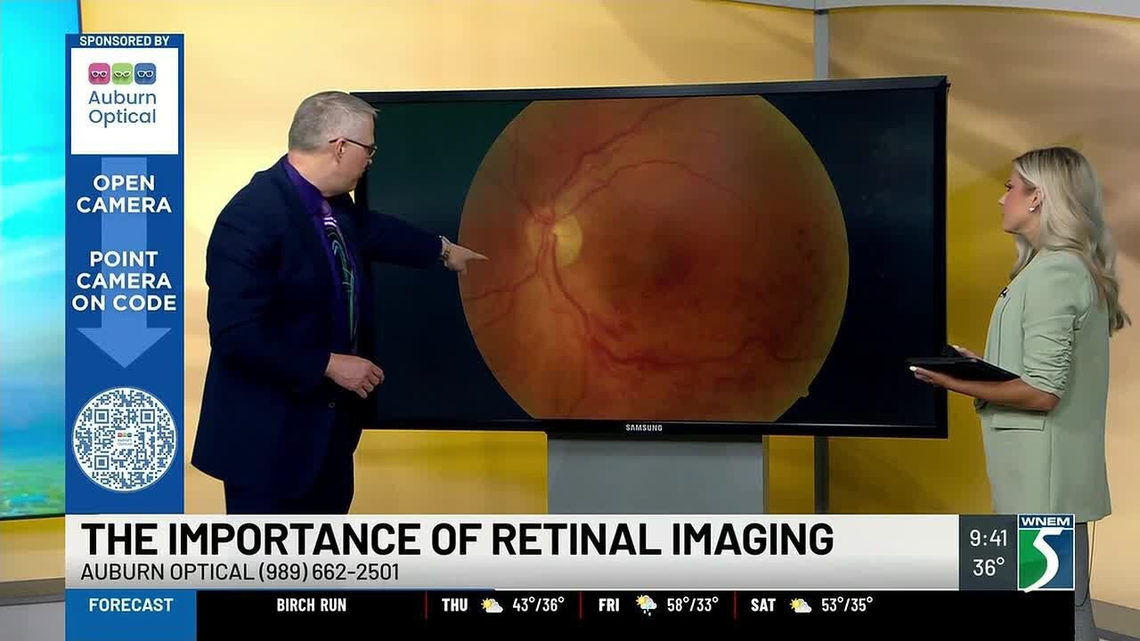 Retinal imaging and why it's important
