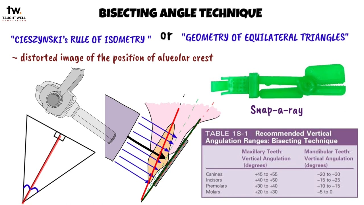 Intraoral radiographic techniques