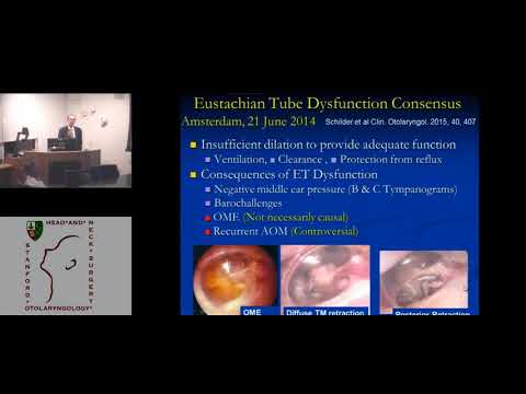Diagnosis & Management of Eustachian Tube Disorders Source