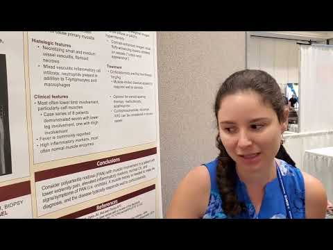 Rare Presentation of Vasculitis with Muscle Involvement: Dr. Liya Stolyar at RWCS 2022
