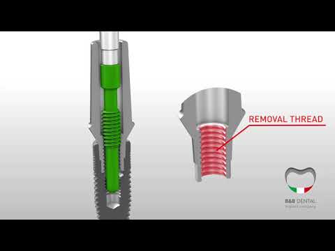 Extractor Tool Protocol USP