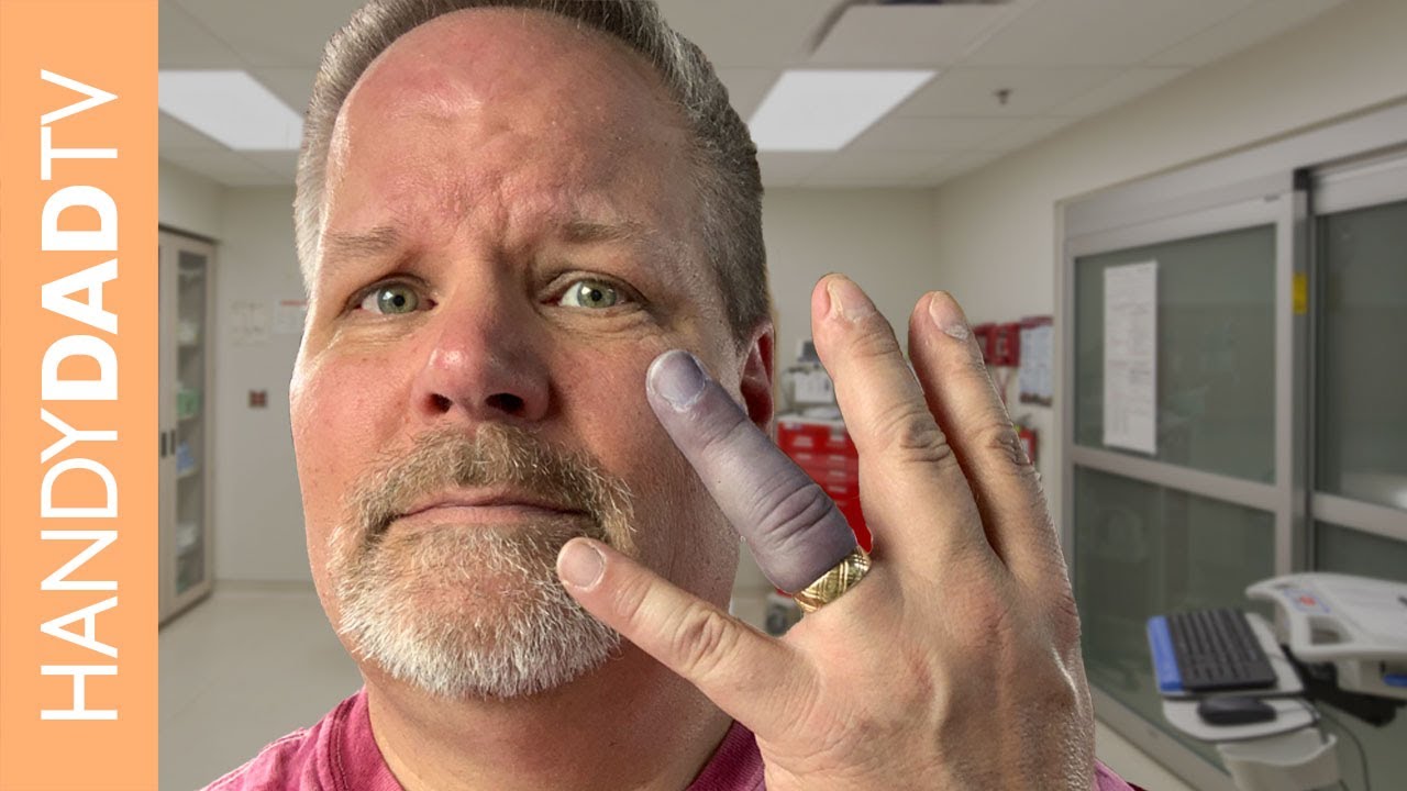 Where to Get Wedding Ring Cut Off