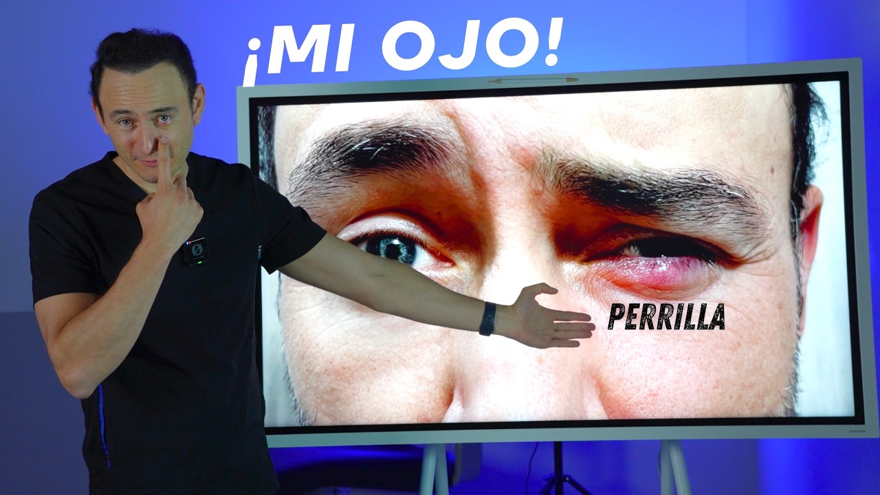 ¡Se me infectó el ojo! ¿Qué sucedió y cómo evitarlo? | Perrilla/Orzuelo