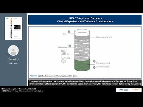 REACT Aspiration Catheters: Clinical Experience and Technical Considerations