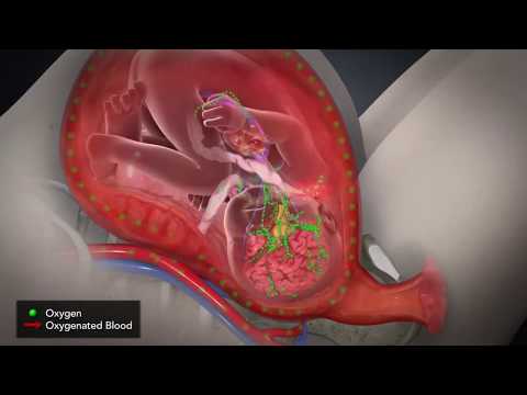 Hypoxic Anoxic Brain Damage Explained by a Lawyer