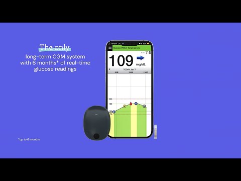 How Eversense Works