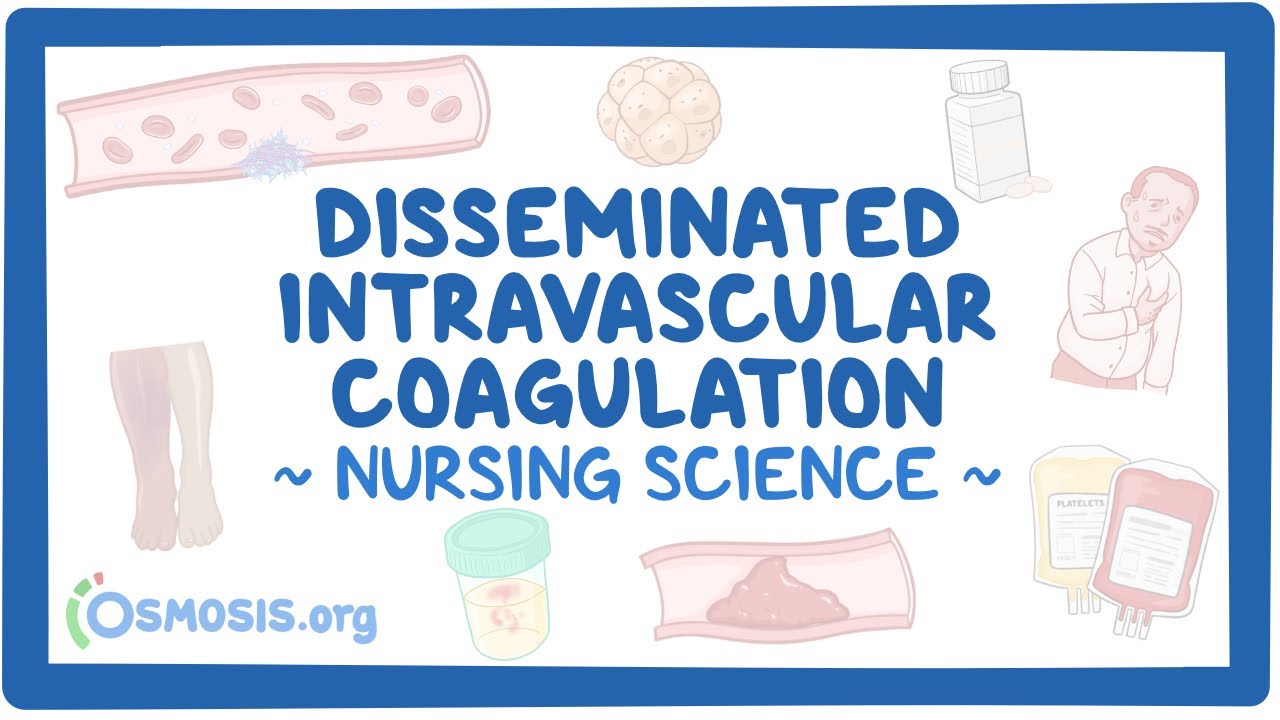 Disseminated intravascular coagulation (DIC): Clinical Nursing Care