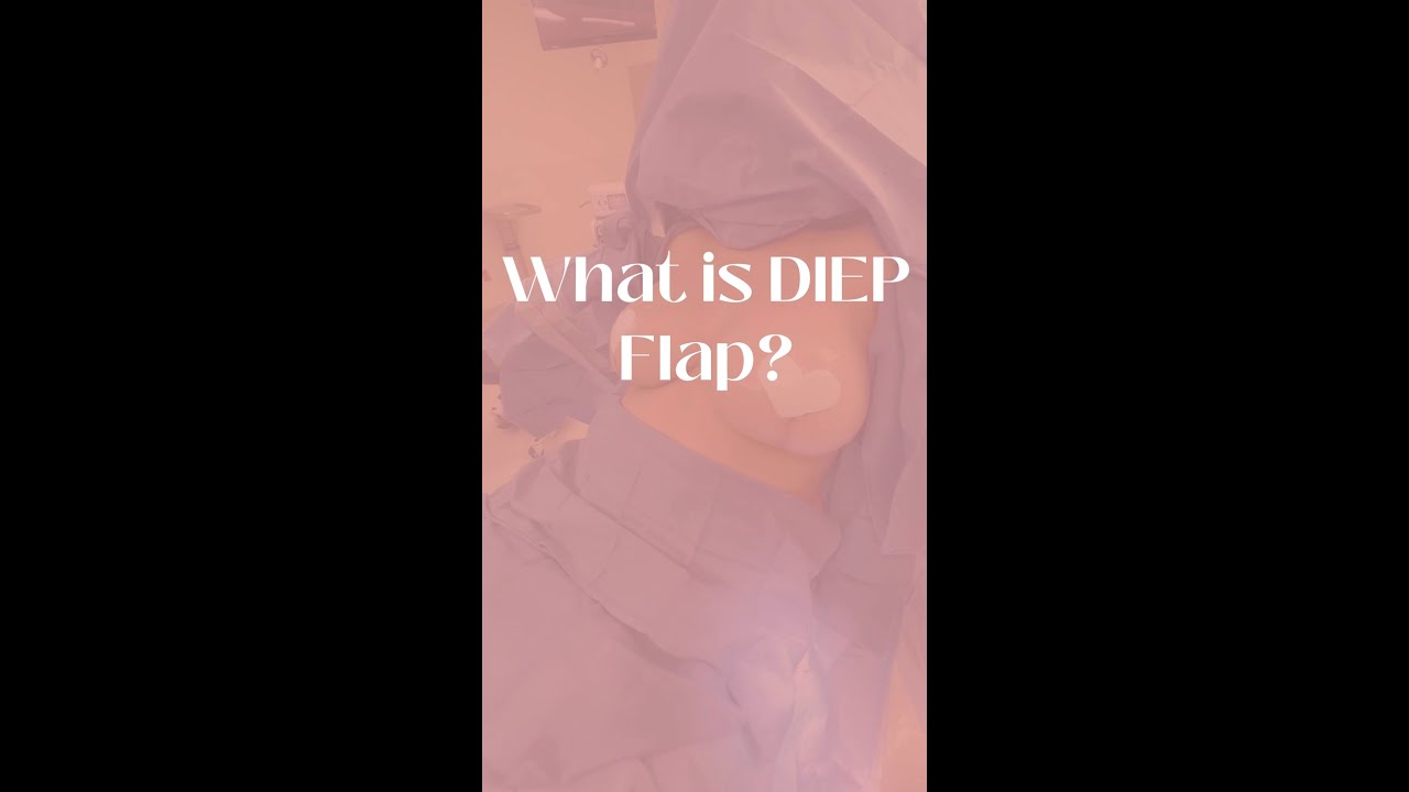 The DIEP flap