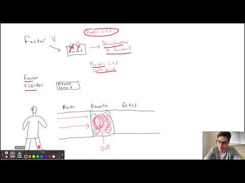 Factor V Leiden