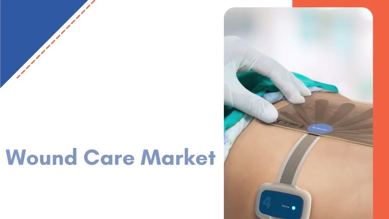 Wound Care Market | Exactitude Consultancy Reports