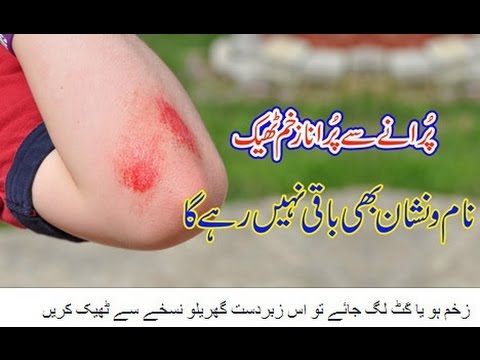 Health tips in Urdu II How to heal wounds fast at home remedies