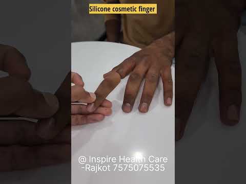 Silicone Cosmetic Finger | Inspire Health Care -Rajkot | 7575075535