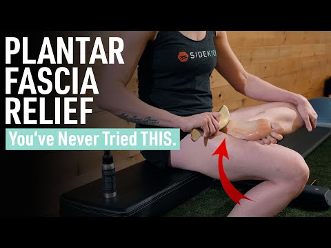 Plantar Fasciitis Relief with Muscle Scraping. Try this if nothing else has worked!