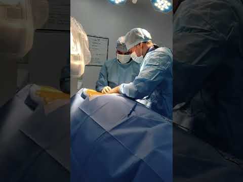 Permanent Pacemaker Implantation