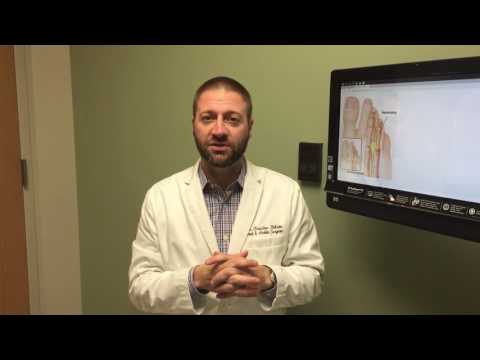 Treatments for Neuroma