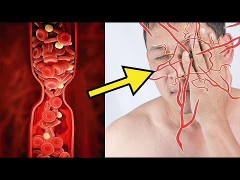 7 Anzeichen, dass dein Körper mehr Magnesium braucht!