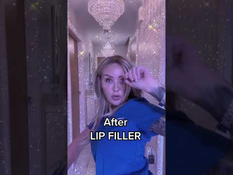 Enhance Your Features with Safe Lip & Botox Treatments #fok