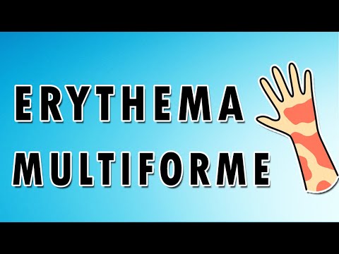 Erythema Multiforme