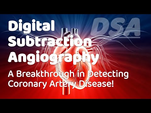 Digital Subtraction Angiography: A Breakthrough in Detecting Coronary Artery Disease!
