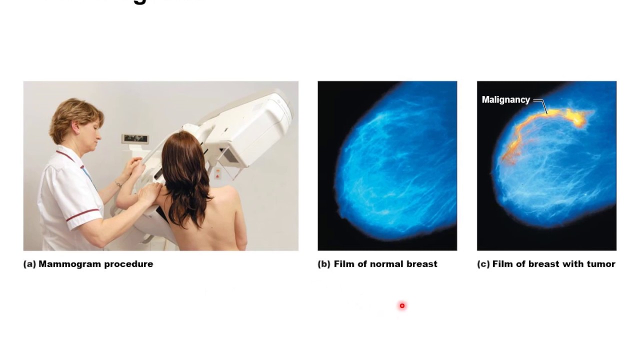 Ch 27, Anatomy, Reproductive System, Female, Part 2