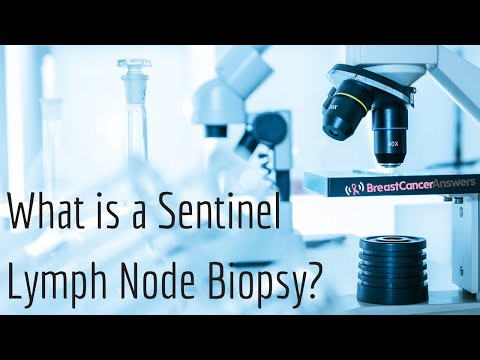 What is a Sentinel Lymph Node Biopsy?