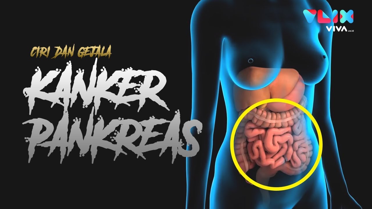 Waspada Kanker Pankreas! Ternyata Ini Penyebab dan Ciri-ciri Gejalanya