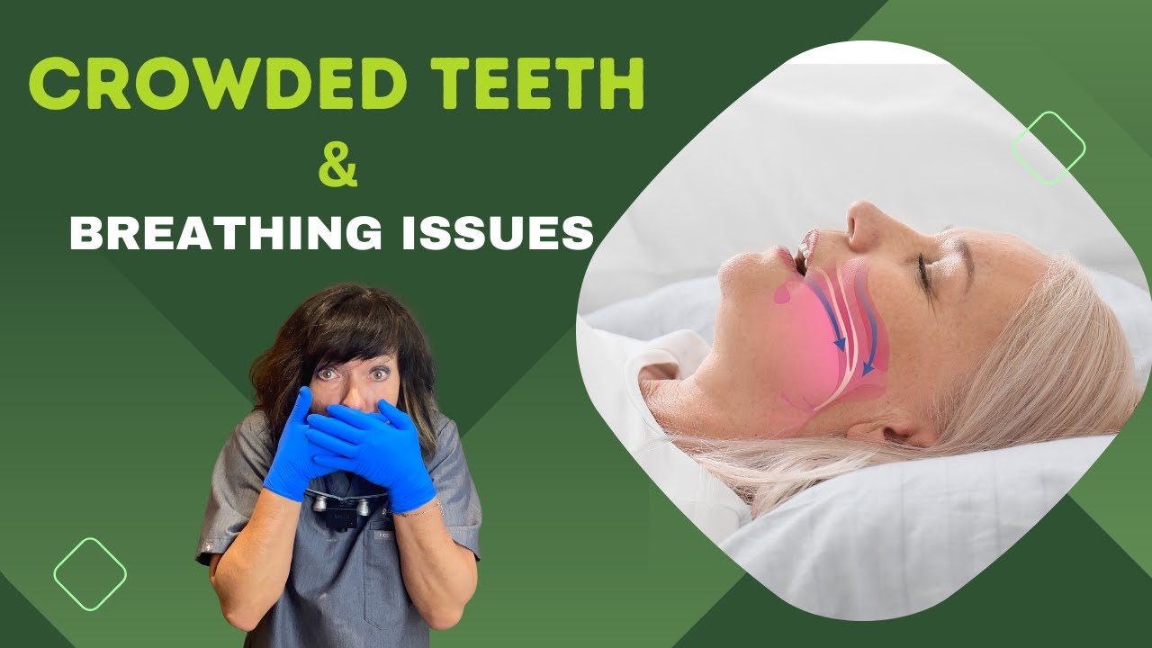 Crowded Teeth & Breathing Issues