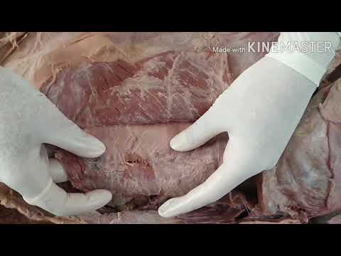 Dissection of Anterior Abdominal Wall by Dr.Meetu Agarwal