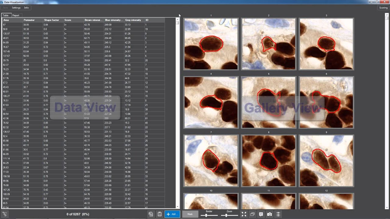 3DHISTECH - NuclearQuant