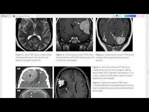 BRAIN IMAGING WITH MRI AND CT