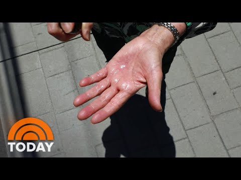 Avoid 9 Hand Sanitizers Containing Methanol, FDA Warns: TODAY’s Headlines | TODAY