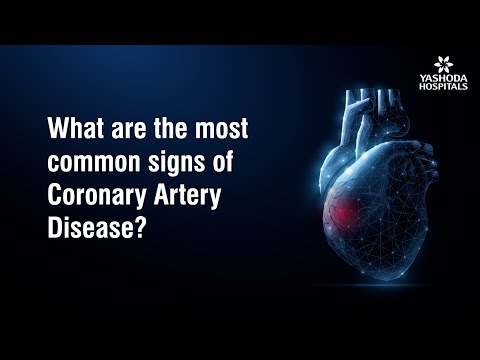 What are the most common signs of Coronary Artery Disease?