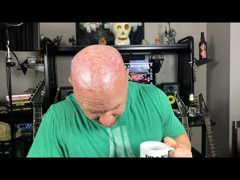 LIFE UPDATE: Don't Amputate My Head (Pre Skin Cancer On My Head)