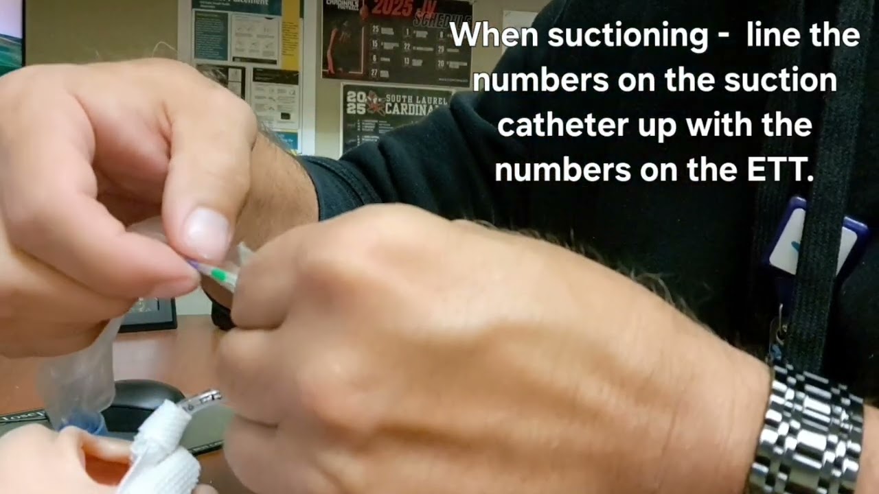Inline Suctioning - Neonate