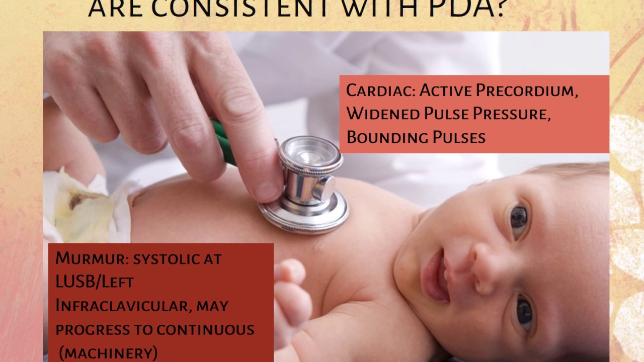 Atrial Septal Defect PPT (Slide Presentation)