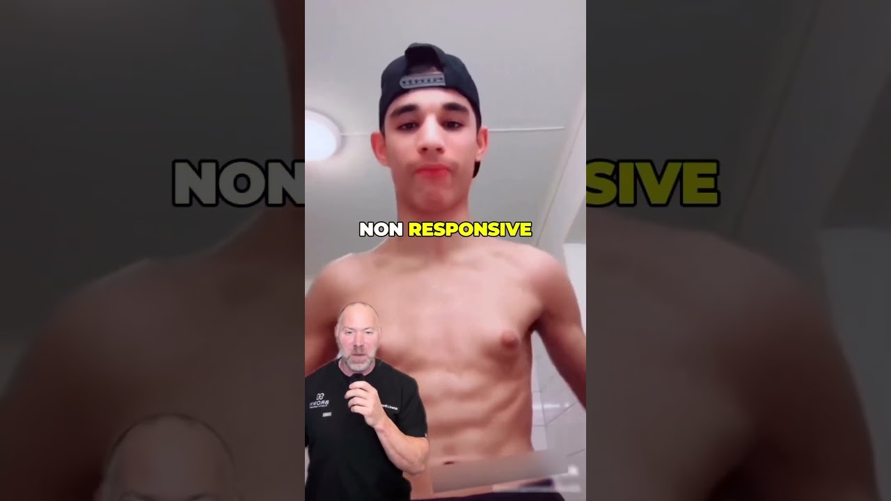 Gynecomastia Isn’t About Weight ❌ #shorts