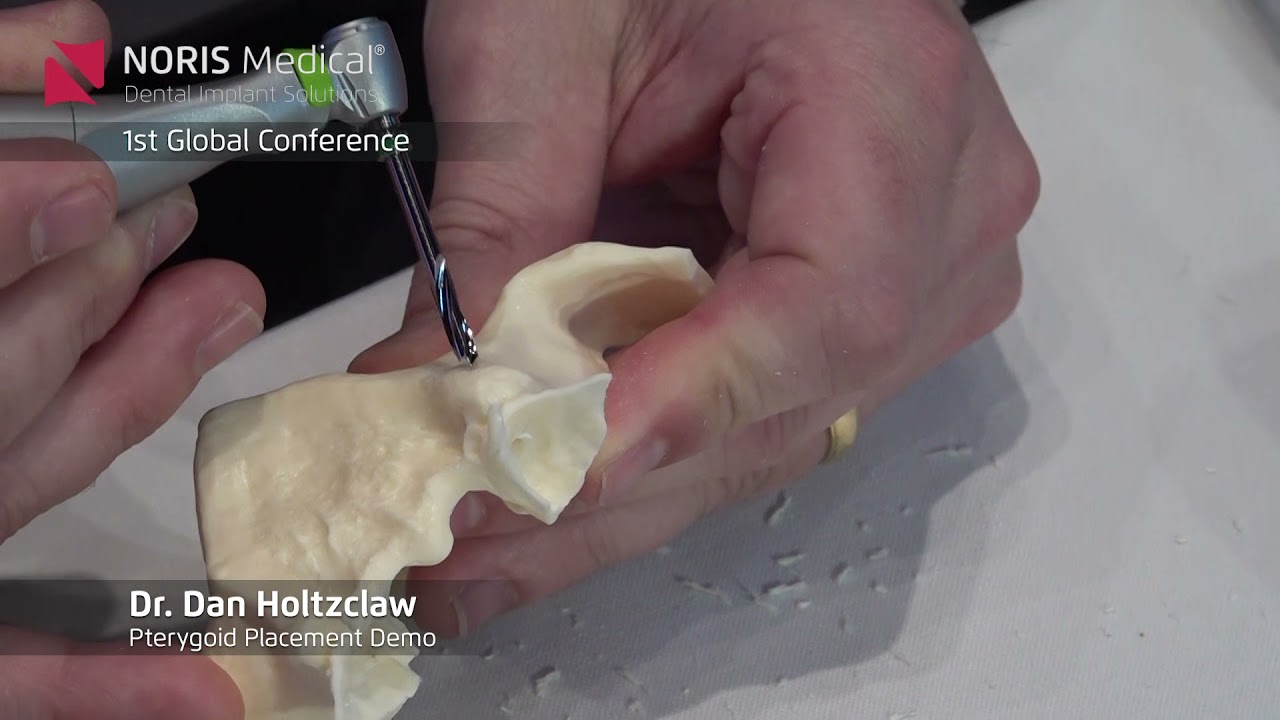 Pterygoid Placement Demo