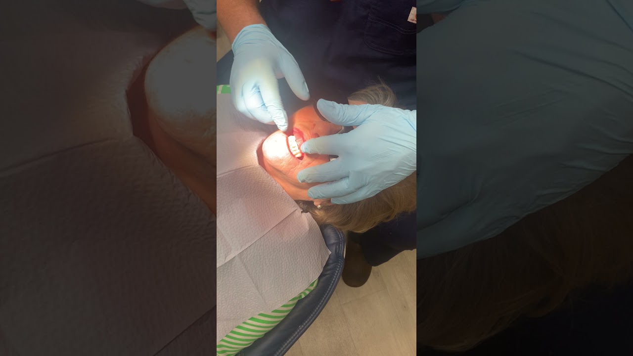Complete Denture Troubleshooting #1
