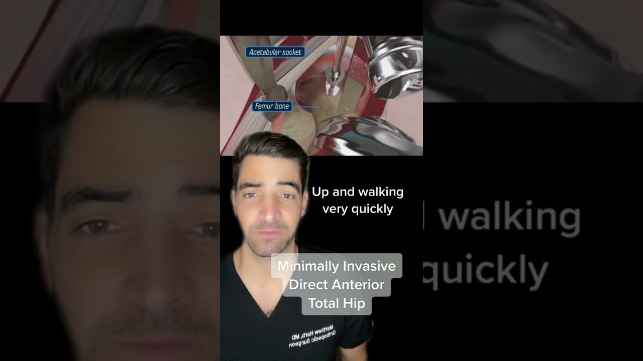 Direct anterior total hip replacement surgery performed by Dr. Matthew Harb