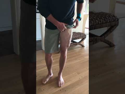Compartment Syndrome (Post-Fasciotomy) #rehabscience