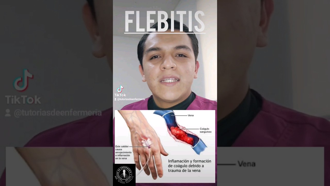 ¿Qué es flebitis? Tipos de flebitis FACIL. #enfermería #salud #flebitis #canalizacion 💉👨🏻‍⚕️