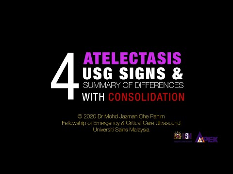 4 atelectasis LUS signs & differences with consolidation