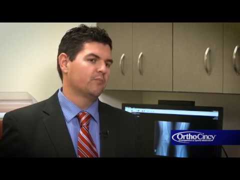 Meniscus Tear - Adam V. Metzler, M.D.