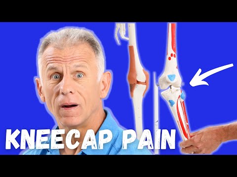 What is Causing Your Knee Pain? Patellofemoral Pain Syndrome or Kneecap Pain? How to Tell?