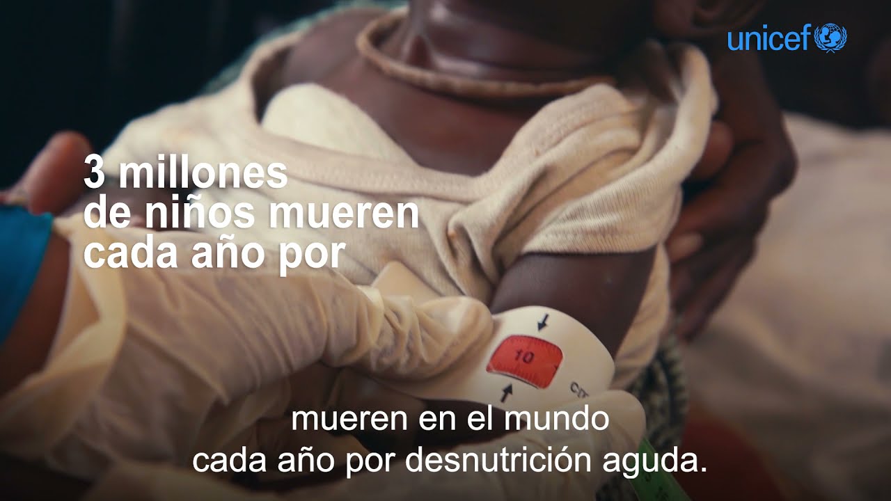 Salvemos a las niñas y niños de la desnutrición, hoy mas que nunca, TE NECESITAN.
