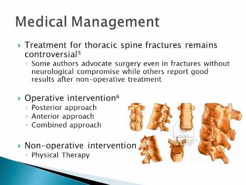 Diagnosis and Management of Thoracic Spine Fractures