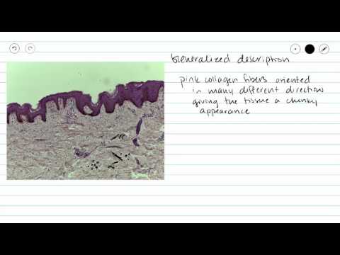 Dense Irregular dense CT proper